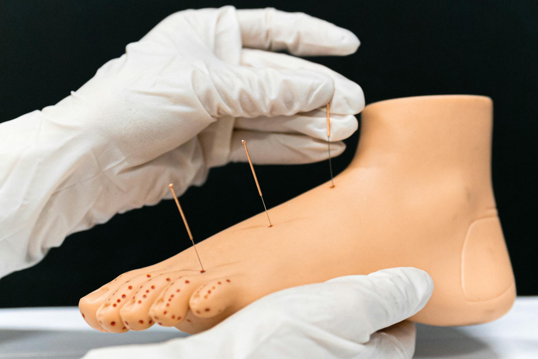 Acupuncture for Plantar Fasciitis: Benefits, Risks, and More