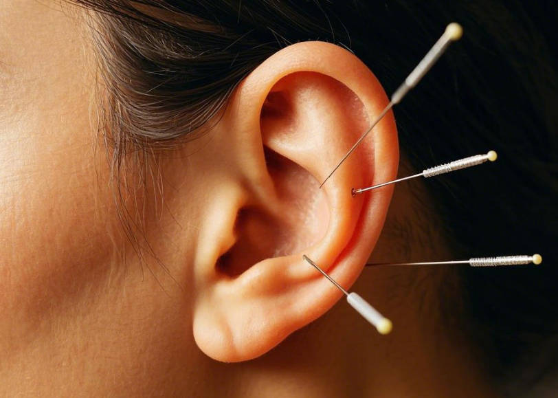 Acupuncture for Ear Pain: What is it? Does it work? - Health Facts Time
